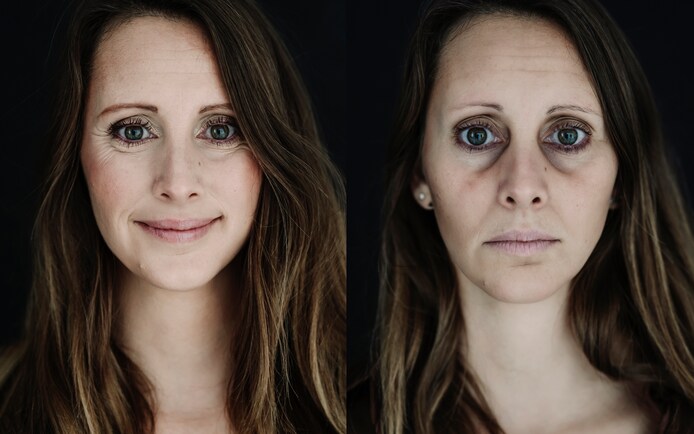 Dit is wat PMDD met vrouwen doet: ‘Op die dagen lijk ik een compleet ...