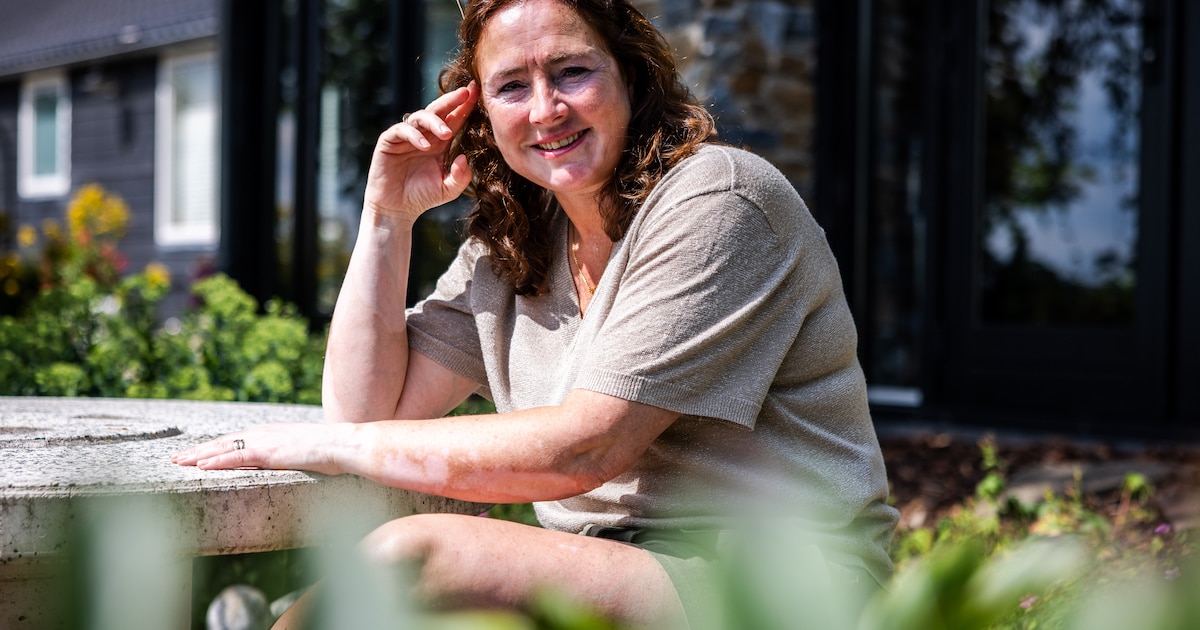 De zomer is door vitiligo een dingetje voor Marije: ‘Ik smeer me ongans ...