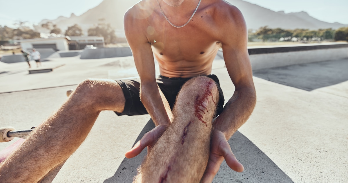 Tetanus kan dodelijk zijn, maar inenting beschermt: dit is wanneer je ...