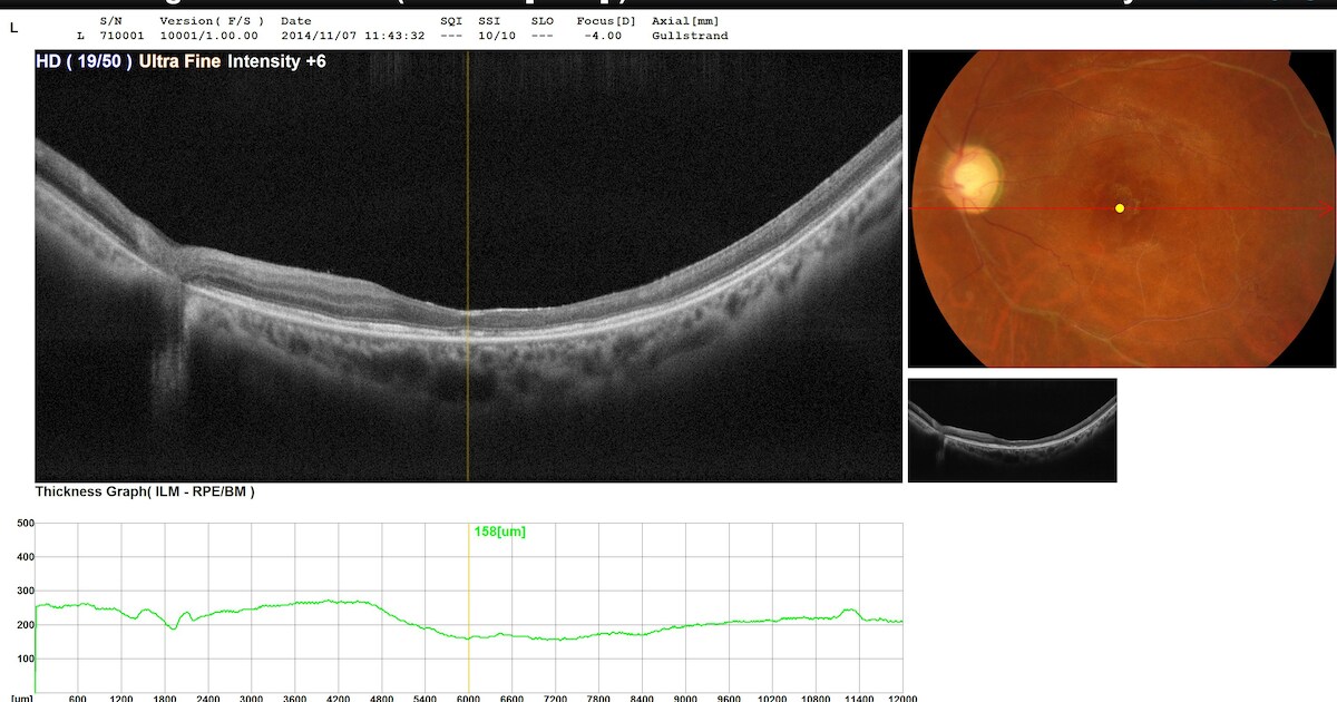 De beste oogzorg dankzij de allernieuwste techniek | Home | AD.nl