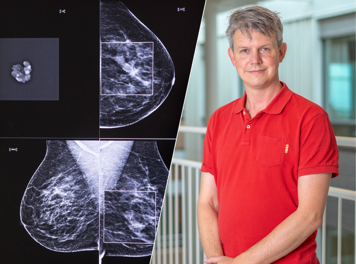 Twee radiologen beoordelen nu scans op borstkanker, maar een van hen ...