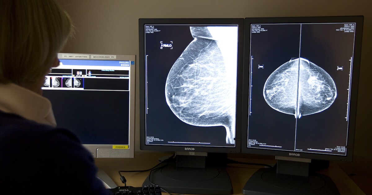 Met knobbeltje in de borst niet naar het ziekenhuis? ‘Het is maar een voorbeeld’, zegt Fleur ...