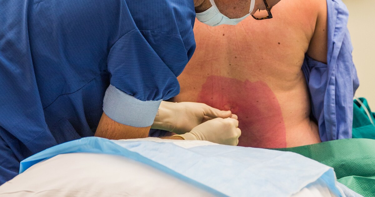 Ruggenprik bij bevalling of niet? In deze provincie gebeurt het veruit ...