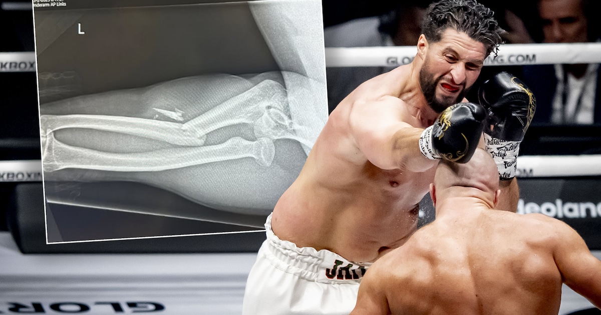 Jamal Ben Saddik breekt arm tegenstander en bekroont rentree met knock ...