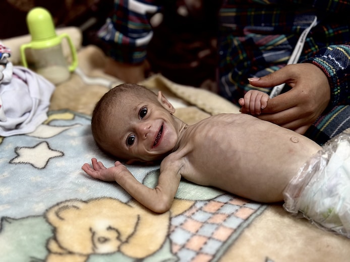 Zes maanden oud, ondervoed en geboren in een ruïne: baby Siwar is het ...
