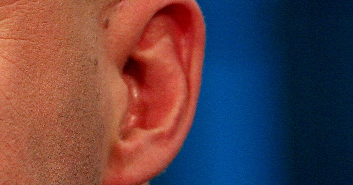 Utrechts onderzoek: flaporen te verhelpen met spalkje en tape | Utrecht ...