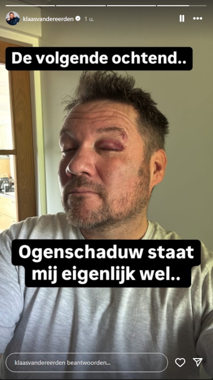 Klaas van der Eerden geraakt door decorstuk tijdens show: ‘Veel bloed ...