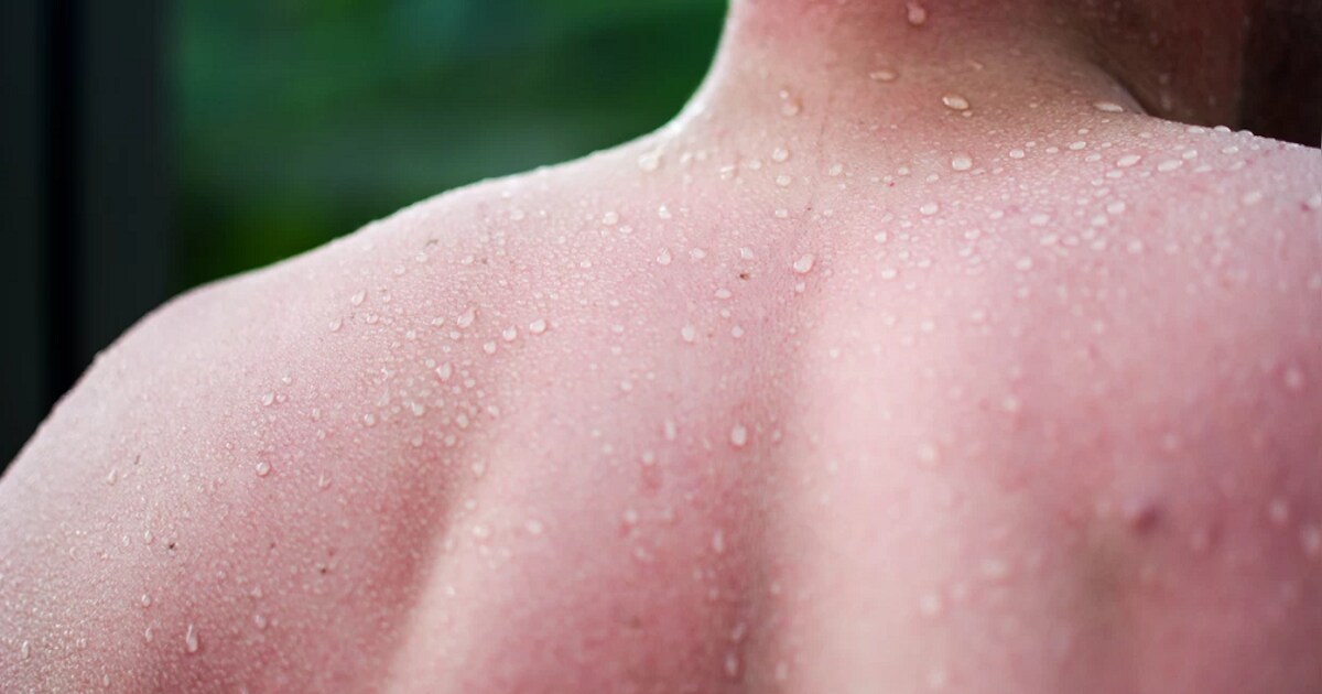 Wat gebeurt er in ons lichaam bij extreme hitte? | Binnenland | AD.nl