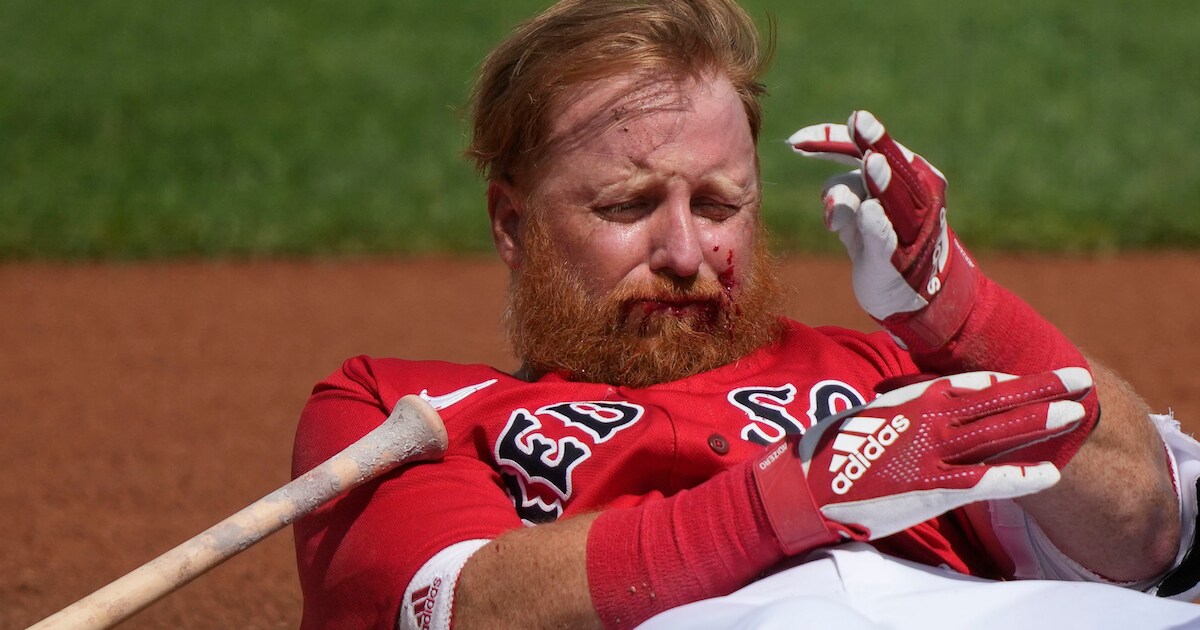 Honkballer Boston Red Sox krijgt bal met ruim 150 km per uur vol in ...