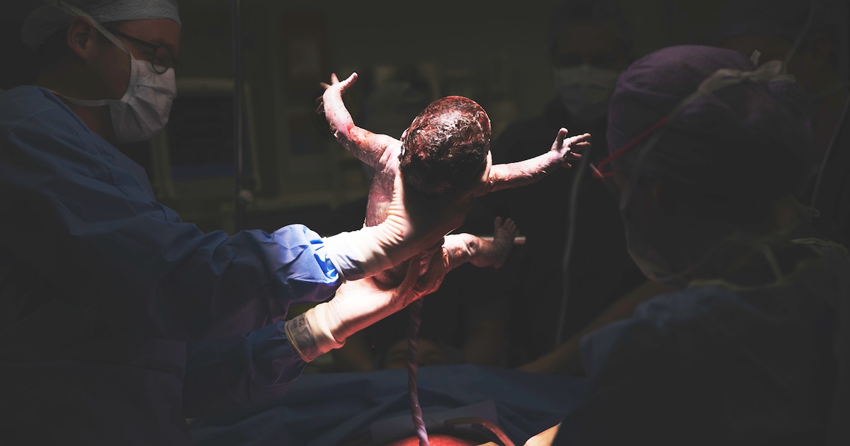 Navelstreng niet doorknippen bij te vroeg geboren baby's biedt ...