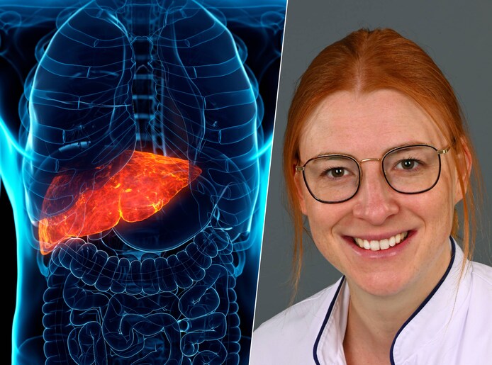 Als je eenmaal levercirrose hebt, dan is dat niet te genezen: dit heeft ...