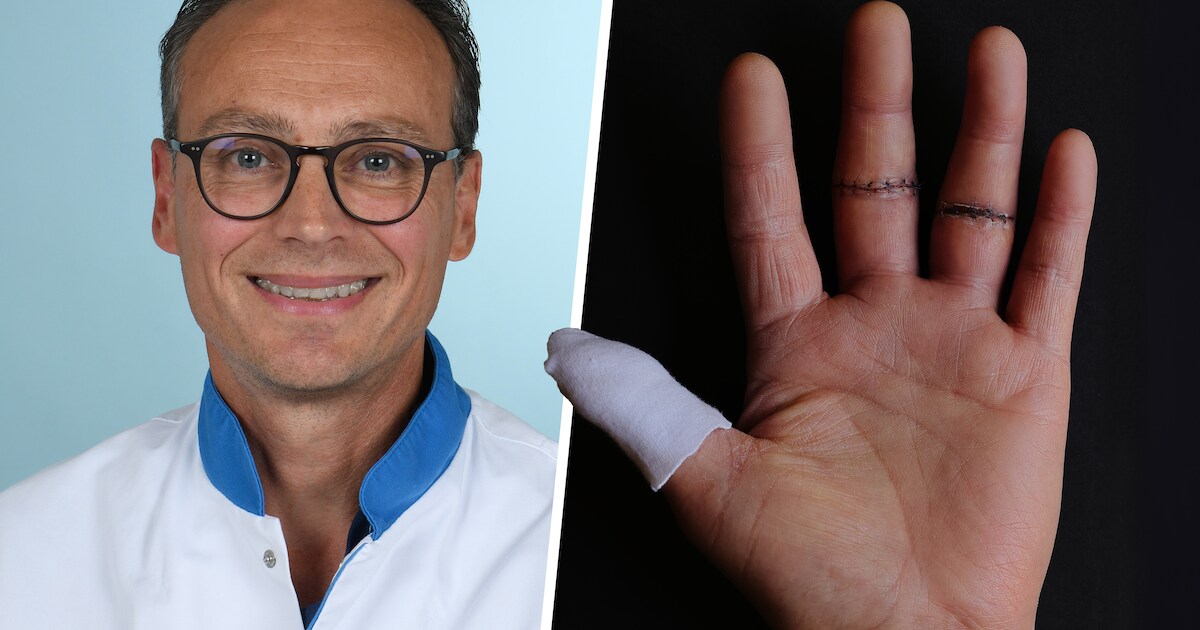 Vrouw verliest vinger op festival: dit moet je volgens arts doen als ...