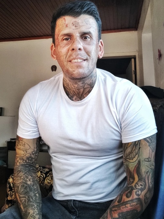 Man die 95 procent van zijn lichaam bedekte met tatoeages wil nu zonder ...