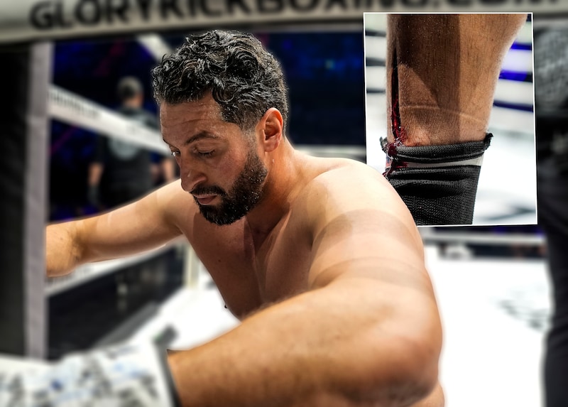 Jamal Ben Saddik vecht tegen tranen in Ahoy, diepe snee beëindigt ...