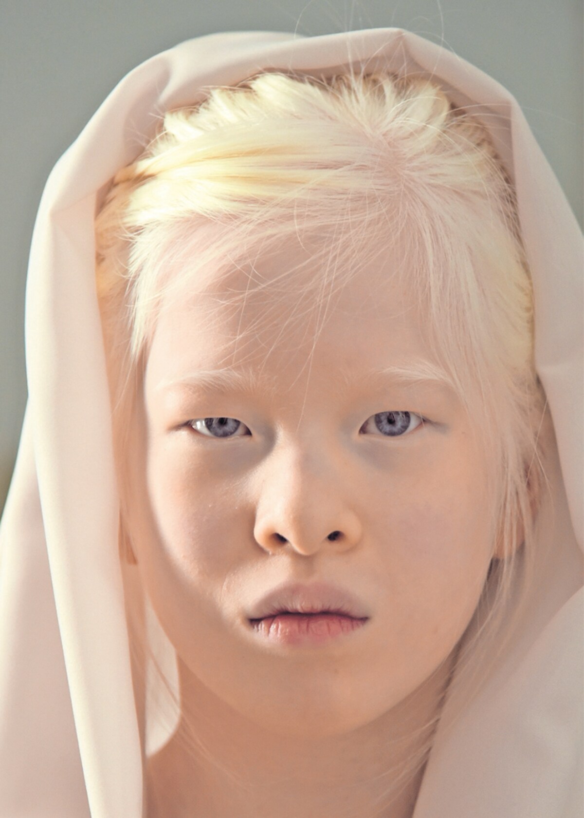 Albino Xueli: van vondeling naar fotomodel met een boodschap ...